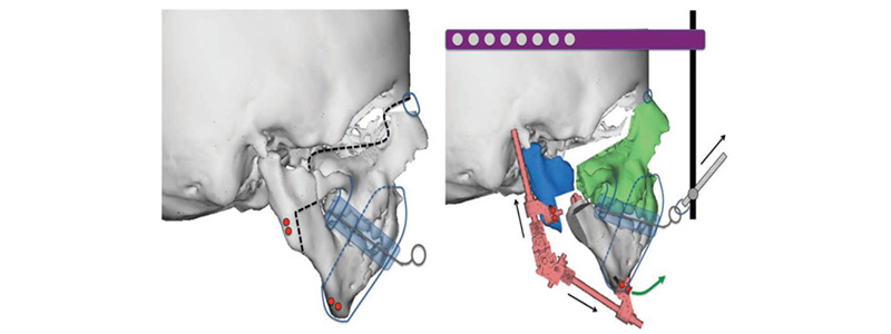 Plastic Surgery Research - Department of Surgery