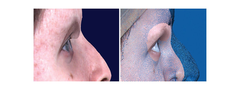 Plastic Surgery Research - Department of Surgery